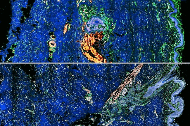 Platform for AAV Delivery… | Harvard Office of Technology Development